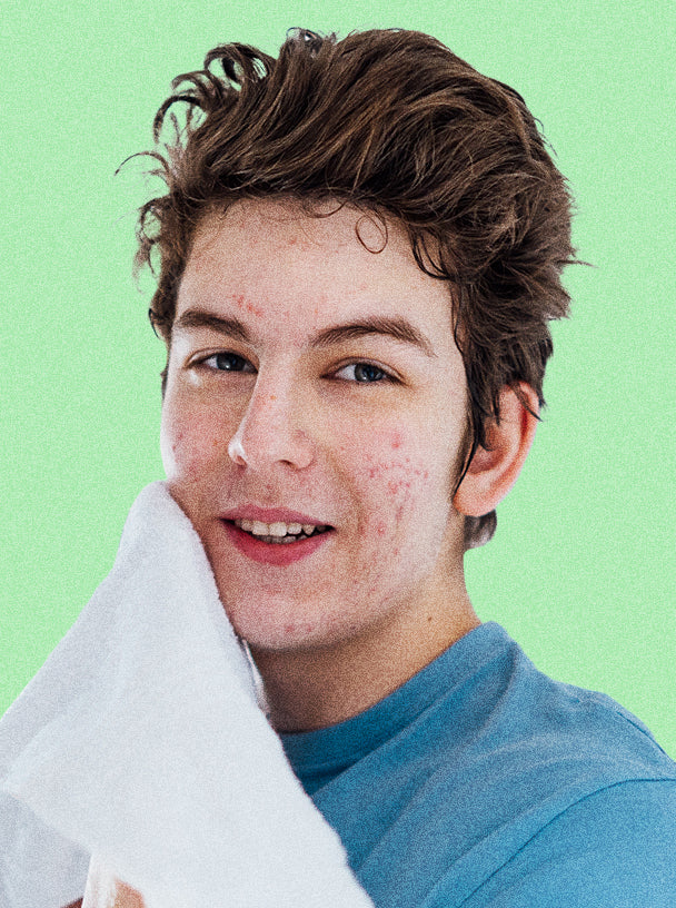 Cleansing Treatment Pads – Oxy® Acne Care